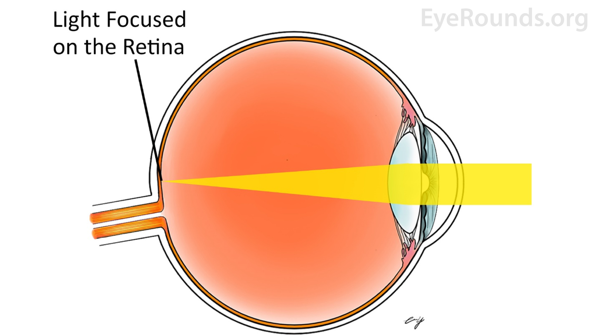 Optics And Refraction From One Medical Student To Another